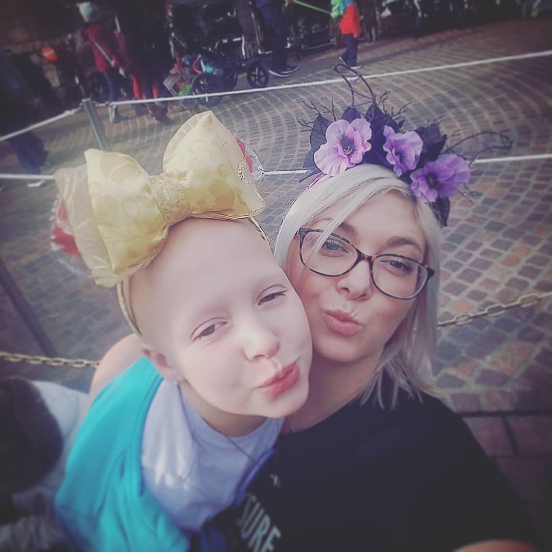 Little Girl With Alopecia Rocks "Crazy Hair Day" At School Says "Now I ...