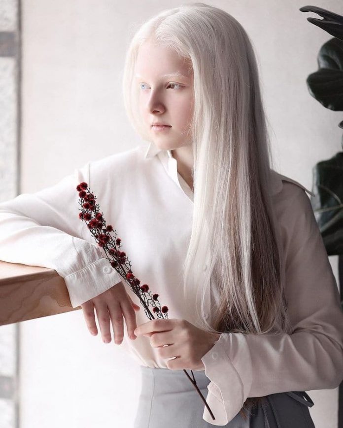 Photographer Captured The Unique Beauty Of A Girl With Albinism And ...